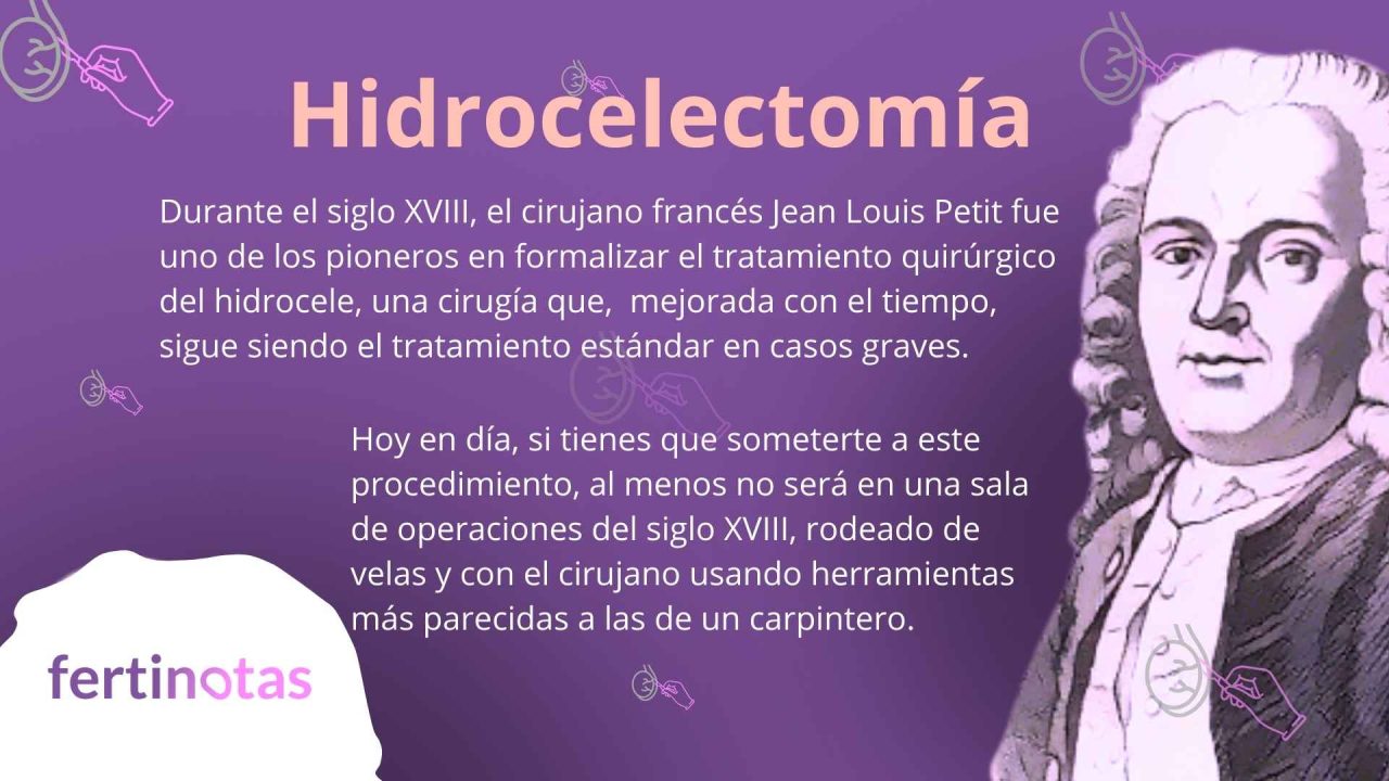 Hidrocele testicular: Síntomas, causas y tratamiento