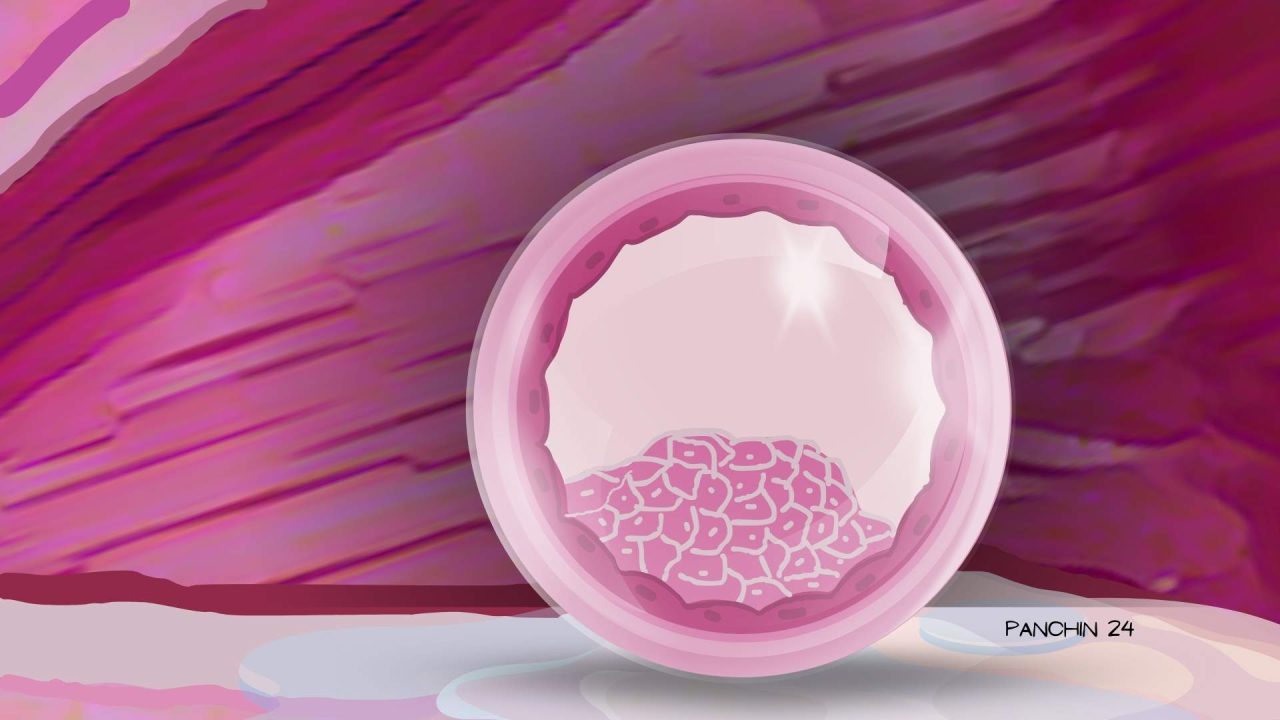 Implantación del embrión: etapas, síntomas y claves del proceso ...