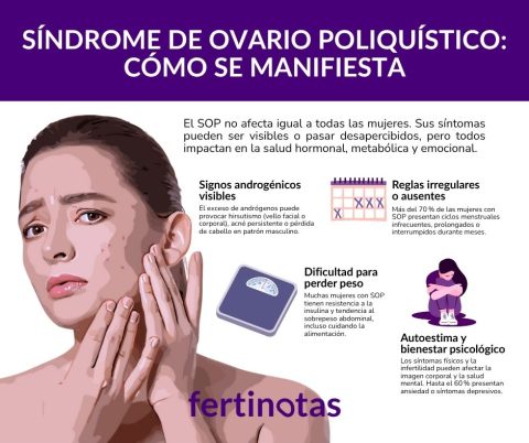 Síndrome De Ovario Poliquístico Síntomas Diagnóstico Y Tratamiento