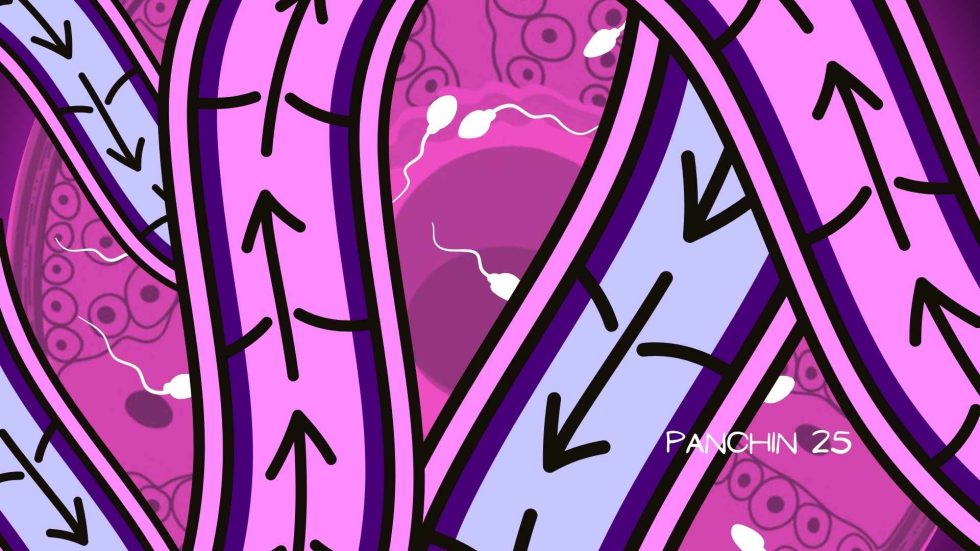 Varicocele testicular: causas, síntomas y tratamiento - Fertinotas